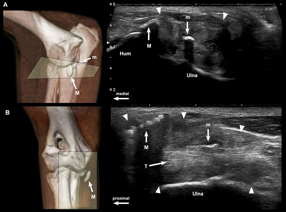 Idiopathic fat necrosis (Bate's body) - Small Animal Ultrasonography