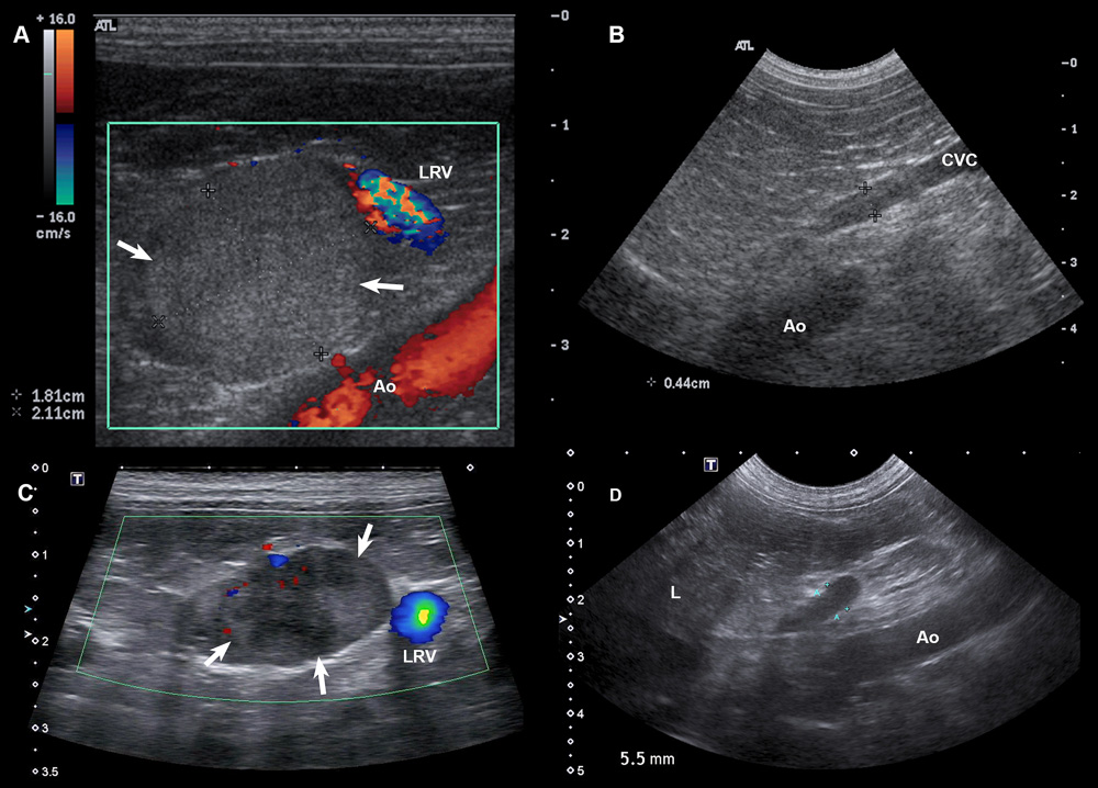 Normal feline kidney - Small Animal Ultrasonography