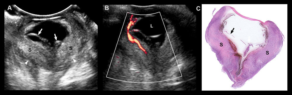 Normal feline kidney - Small Animal Ultrasonography