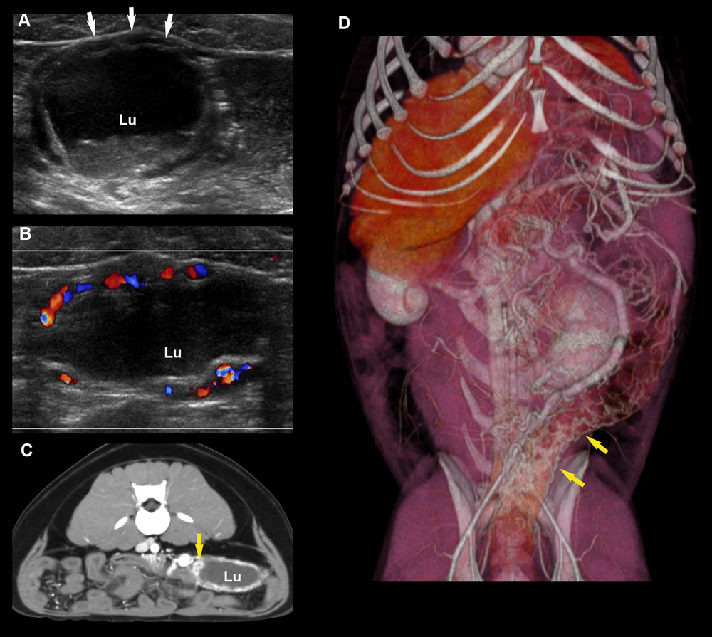 Ultrasound Anatomy Abdomen Abdominal Ultrasound Scan Ultrasound Scan
